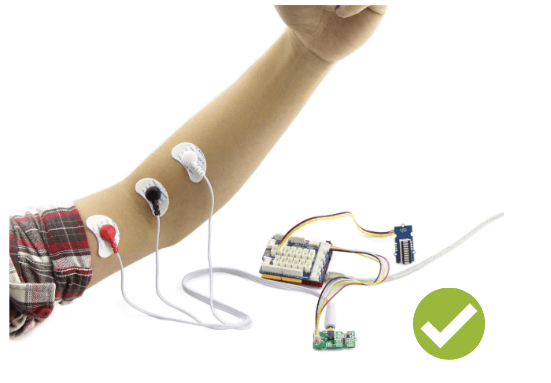 What is EMG sensor, Myoware and How to use with Arduino? - Latest News ...