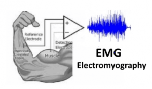 What is EMG sensor, Myoware and How to use with Arduino? - Latest News ...